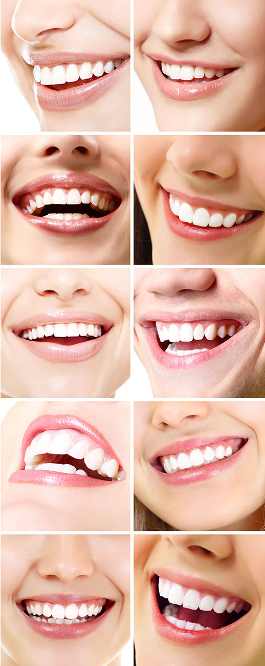 Smile Design in Istanbul - Dr. Dt. Melih Şengül - Prosthodontist / DDS